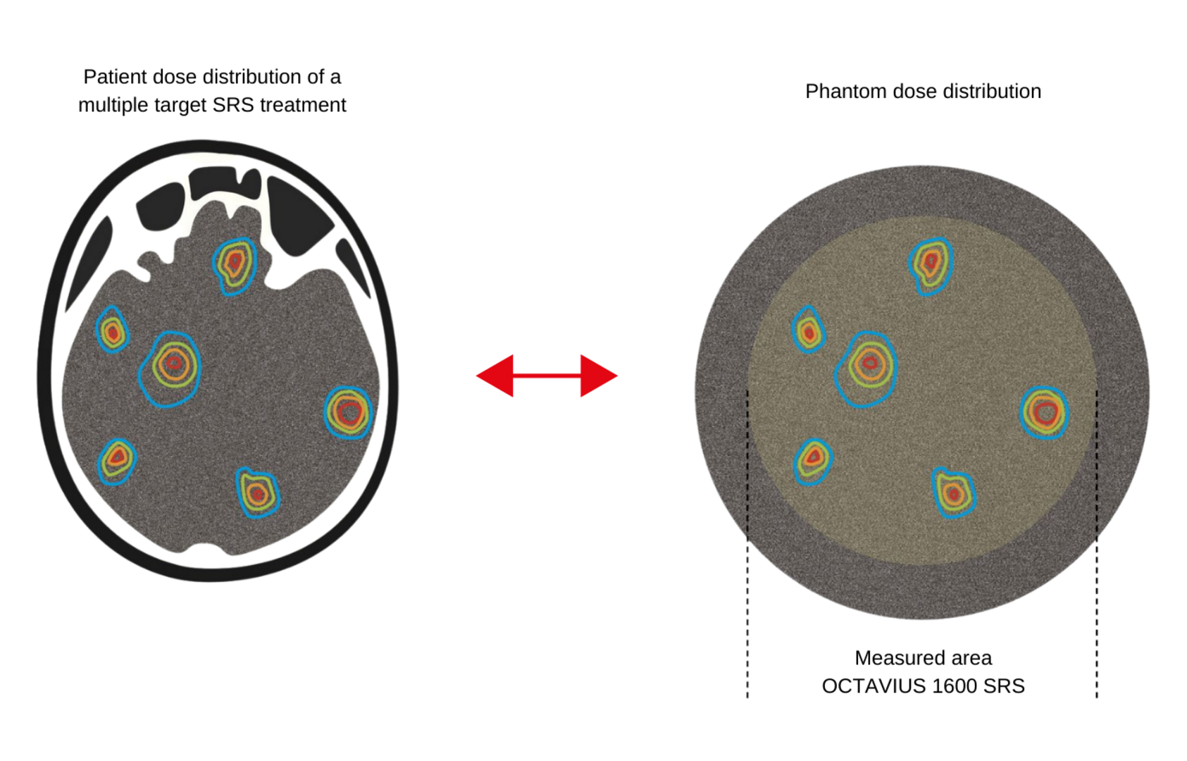 OCTAVIUS Detector 1600 SRS | PTW