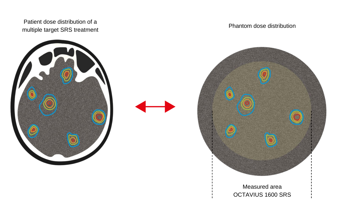 OCTAVIUS Detector 1600 SRS | PTW