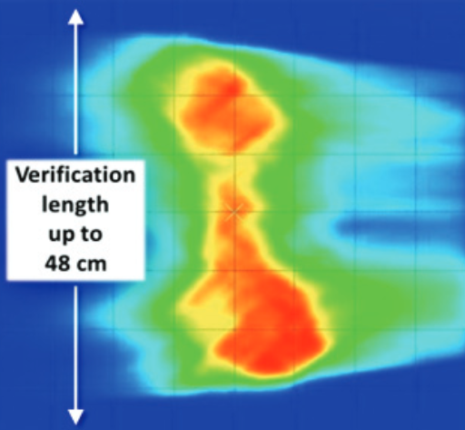 OCTAVIUS Detector 1500 | PTW